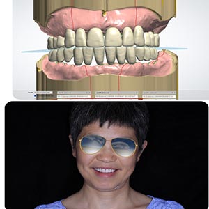 Best Prosthodontist near Fredericksburg VA | Innova Prosthodontics ...